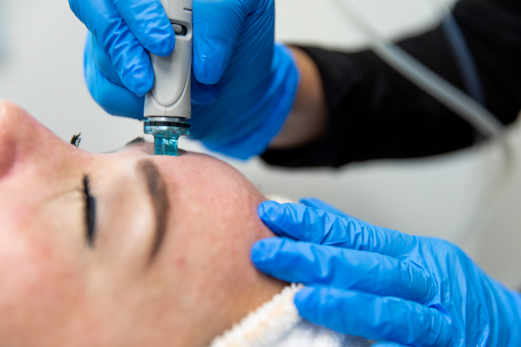 HydraFacial in Chicago | ReJenerate Aesthetic Studio